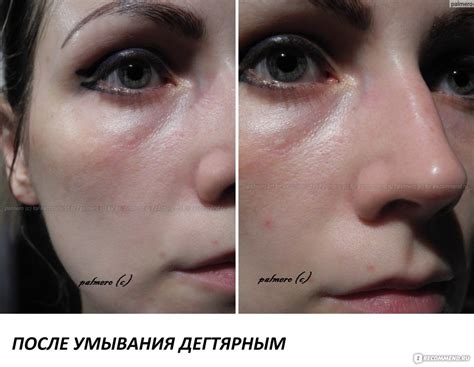 Очиститель пор лица Gezatone Super Wet Cleaner Вакуумный аппарат ...