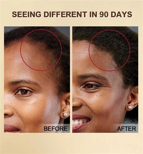 Oem Natural Castor Argan Hair Regrowth Tonics Ginger Hair Growth Oil ...