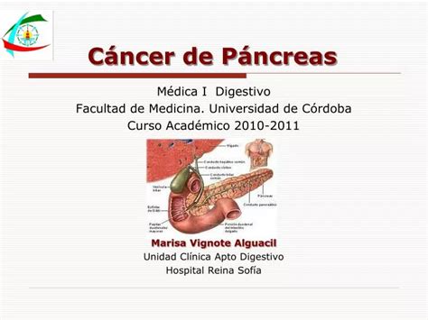 PPT - Cáncer de Páncreas PowerPoint Presentation, free download - ID:5646291