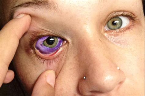 Eyes Change Color When Sick at Carissa Richards blog