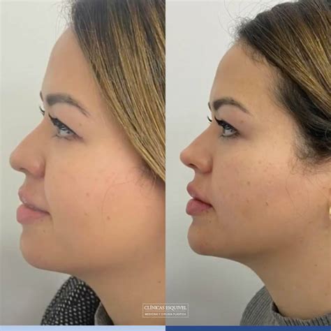 Armonización Facial. ¿Qué es y cuáles son sus beneficios? – Clínicas ...