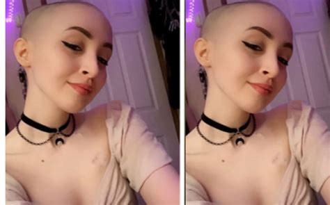 Joven paga tratamiento de cáncer con cuenta de OnlyFans - Fama