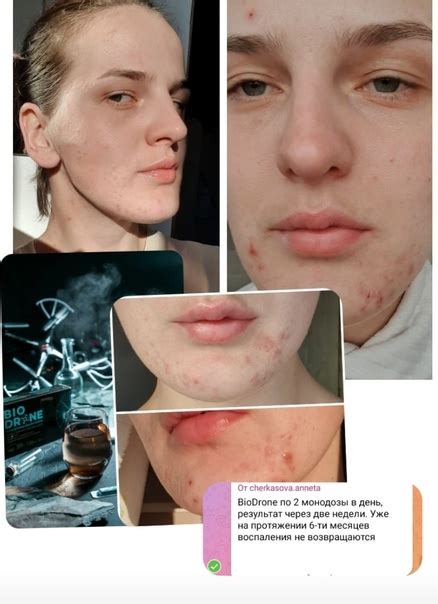Отзывы #Биодрон#Биотюн# | NL International/Похудение/уход/Красота ...