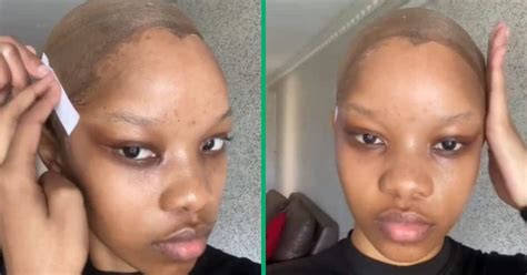 Woman Does DIY Facelift Before Wig Install in TikTok Video, SA Peeps ...
