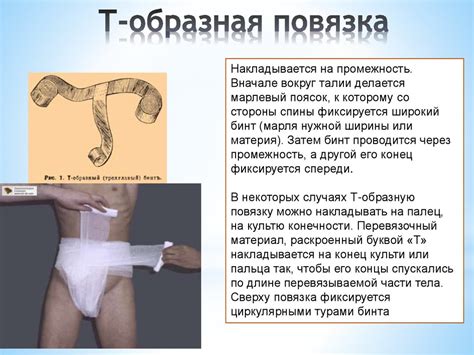 Десмургия. Перевязочный материал - презентация онлайн