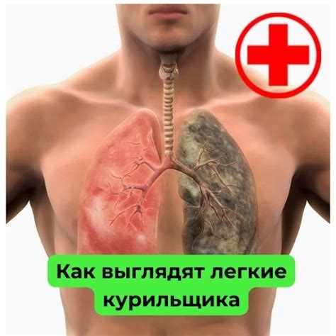 Легкие курильщика как выглядят, фото, как очистить легкие курильщика