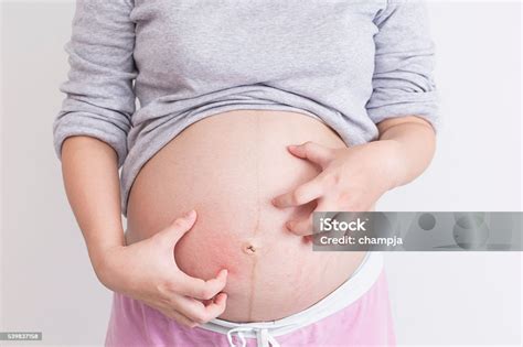 Pregnant Woman Scratching Her Belly Stock Photo - Download Image Now - Pregnant, Scratching ...