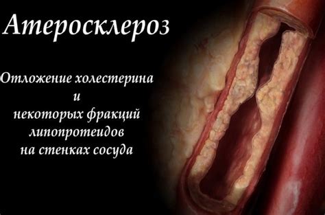 Этилметилгидроксипиридина сукцинат: инструкция по применению, торговое ...