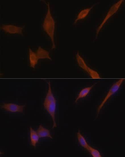 MLPH Antibody (PA5-109965)
