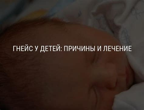 Гнейс у детей: причины появления корочек на голове у ребенка и удаление ...