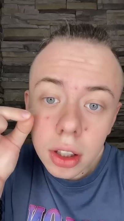 ПЛАСТЫРИ ВЫТЯГИВАЮЩИЕ ПРЫЩИ 🤯 #shorts - YouTube