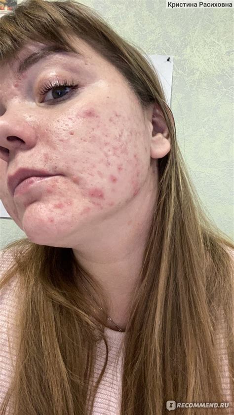 Тоник для лица Kora phytocosmetics для жирной и смешанной кожи с ...