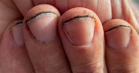 Here's What The Colour Of Your Nail Gunk Means | HuffPost UK Life