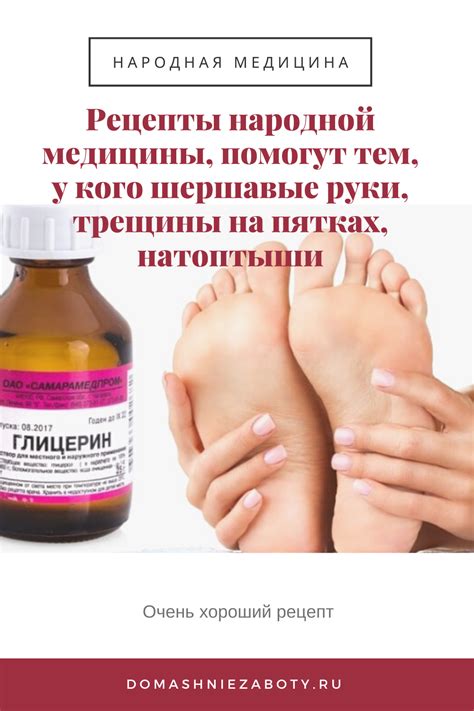 Трещины на пятках - лечение и профилактика