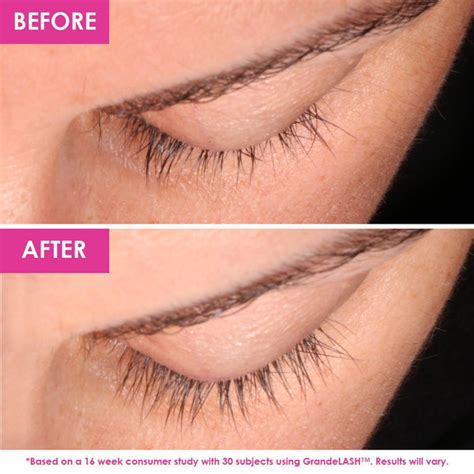 GrandeLASH™ Lash Enhancing Serum – Grande Cosmetic Canada
