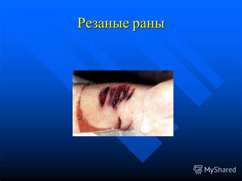 Презентация на тему: "Повреждения от действия тупых и острых предметов ...