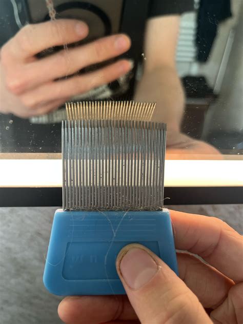What are those specks in the comb? My hair itches but it’s not lice : r/Hair