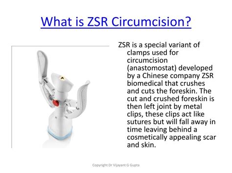 PPT - Circumcision and Phimosis PowerPoint Presentation - ID:7704952