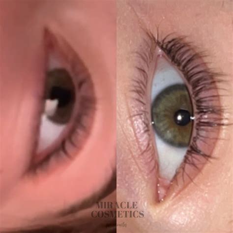 Eyelash Growth Serum – Miracle Cosmetics