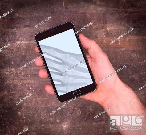 Smartphone display showing an x-ray, Stock Photo, Picture And Low ...