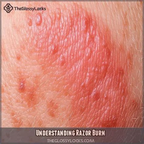 Razor Bumps Vs Razor Burn: Causes, Prevention & Expert Treatment Tips