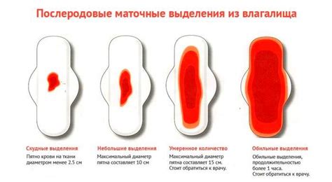 Живот после родов: как убрать и через сколько уходит