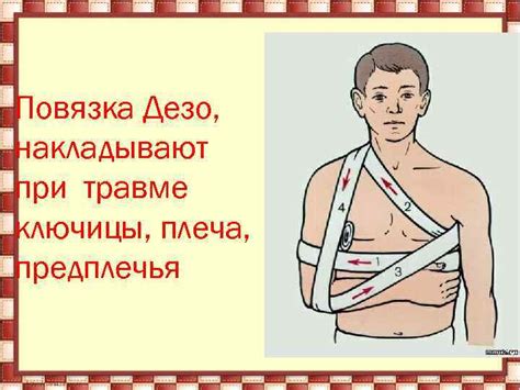 Наложение повязок Наложение повязок Спиральная повязка Восьмиобразная