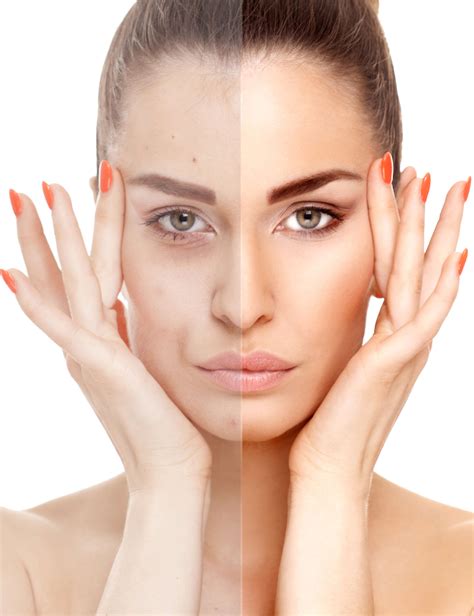Контурная пластика лица - NKDERM