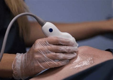 УЗИ суставно-мышечной системы - Эффективная диагностика в Biruev Clinic ...