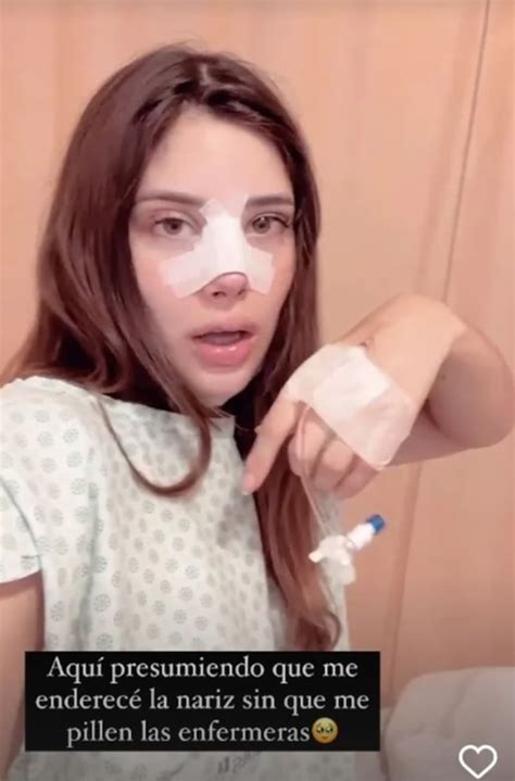 “Para arreglarme...”: Revelan impactante cambio de Icata tras operación estética – Publimetro Chile