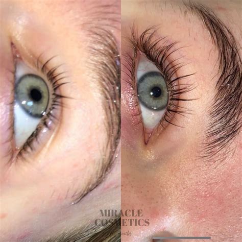 Eyelash Growth Serum – Miracle Cosmetics