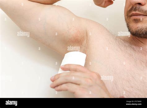 Rash After Using Deodorant at Charles Zeigler blog