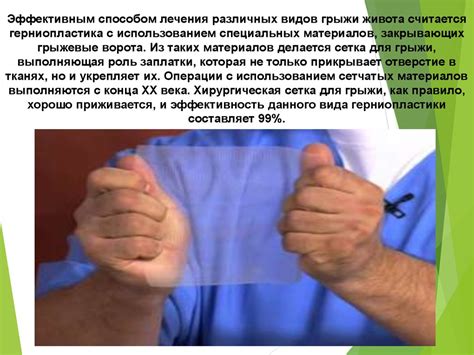 Герниопластика для лечения различных видов грыжи живота - online ...