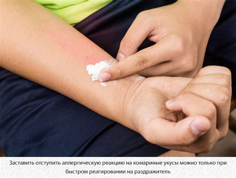 Отек после укуса комара: чем и как снять – эффективные средства от зуда ...
