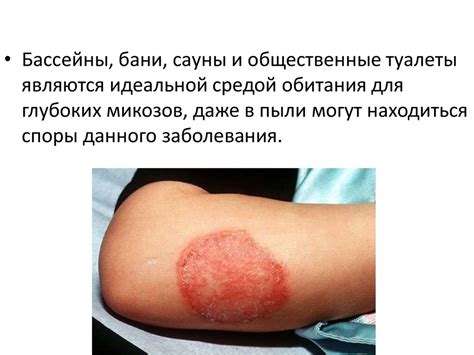 Санитария и гигиена парикмахерских услуг: Кожные заболевания ...