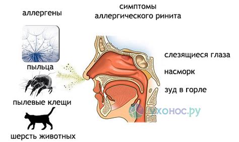 Течет из носа: когда это норма, патологические причины, как лечиться в ...