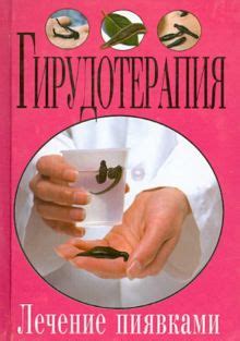 Книга: "Гирудотерапия. Лечение пиявками" - Елена Храмова. Купить книгу ...