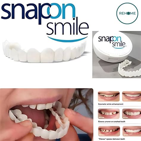 Snap on Smile Teeth Veneer Braces - (IMPORTED) – REHOME