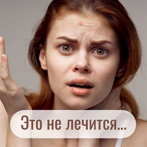 Это не лечится… Печально но факт. Это не проблема, это заболевание кожи ...
