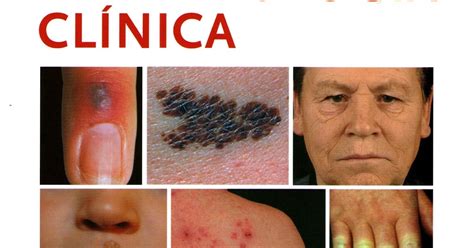 LA BIBLIOTECA DEL DUME: ATLAS DE DERMATOLOGÍA CLÍNICA - FITZPATRICK 7MA ...