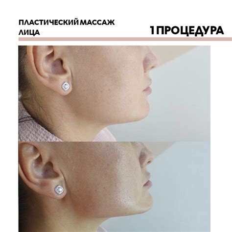 Скулы - студия массажа лица и косметологии