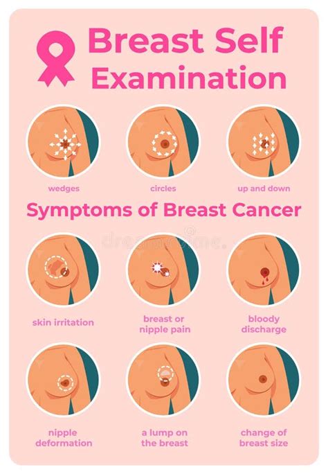 Examen De Cáncer De Mama Infografía De Los Síntomas Oncológicos Del Tumor, Dibujos Animados ...