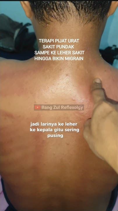 TERAPI PIJAT SAKIT PUNDAK MENJALAR KE LEHER, KEPALA, BELIKAT DAN LENGAN ...