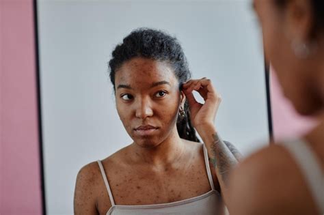Premium Photo | Young black woman with acne scars looking in mirror ...
