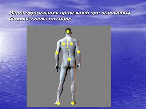 Пролежни (профилактика, лечение) - презентация онлайн