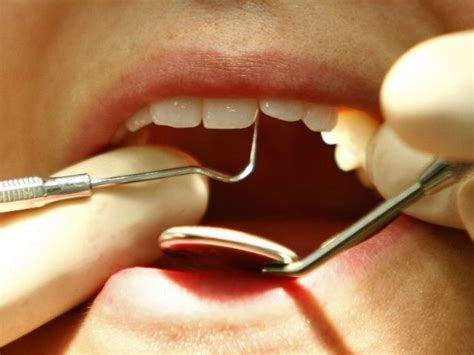 Cosmetic Oral Treatments - Hearing Aid Tax Credit - The Age Of Hearing Aid